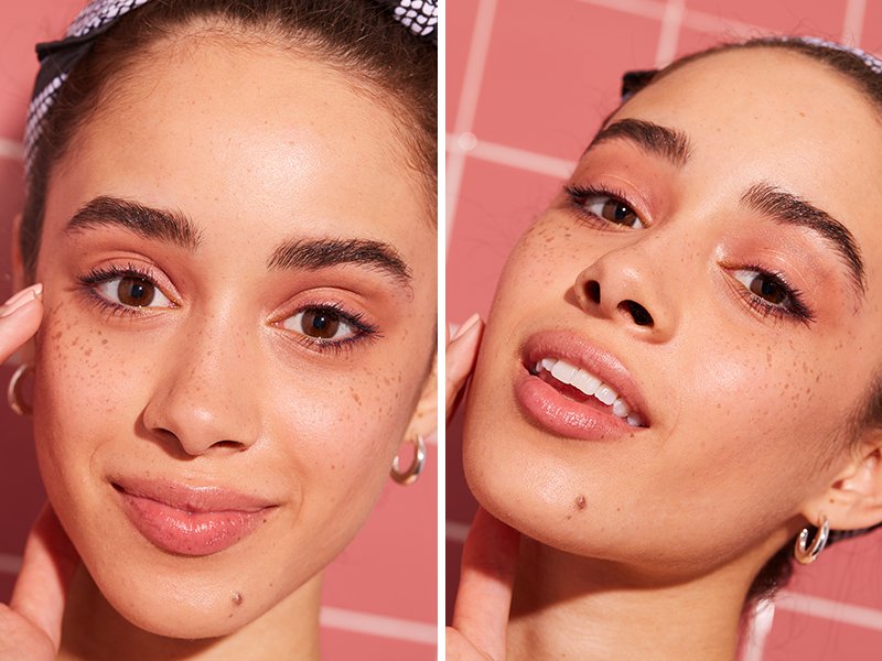 The Difference Between Freckles and Sun Spots | Skincare.com